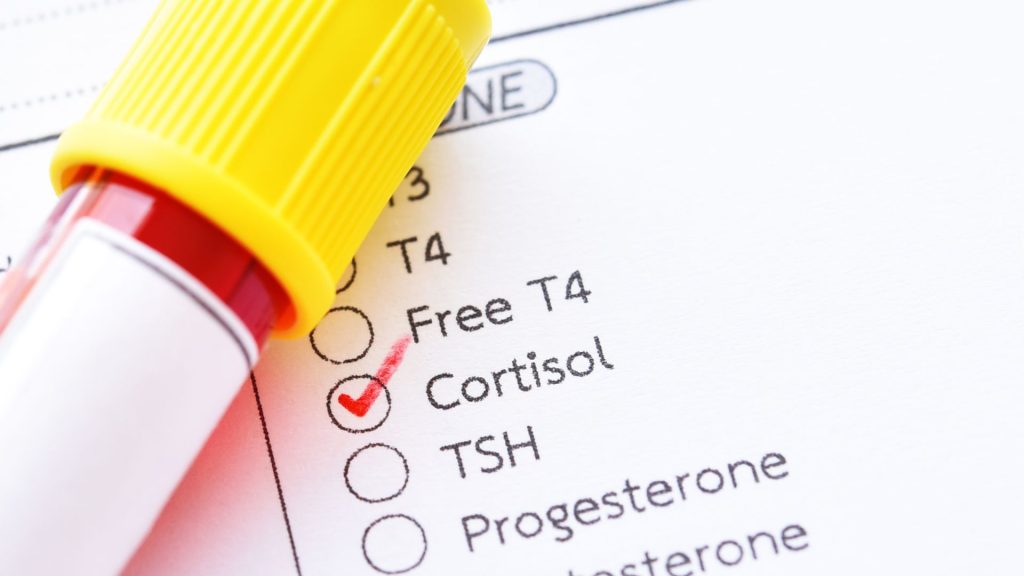 How Hormone Testing Can Help You Understand Your Health