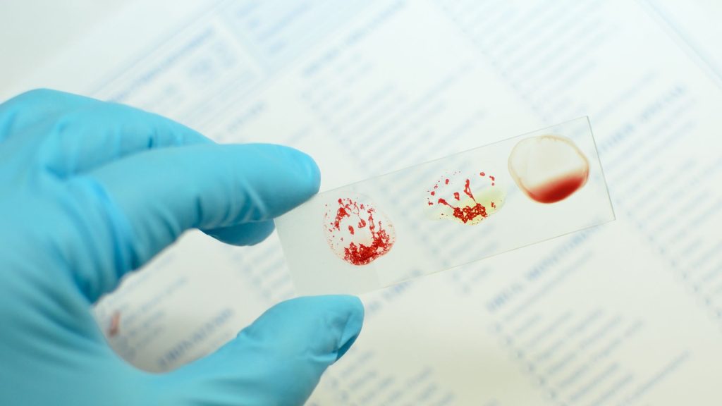 How Hormone Testing Can Help You Understand Your Health